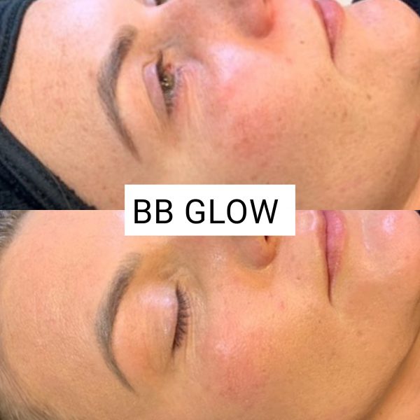 BB Glow (semi-permanent foundation) – Fantasy MedSpa