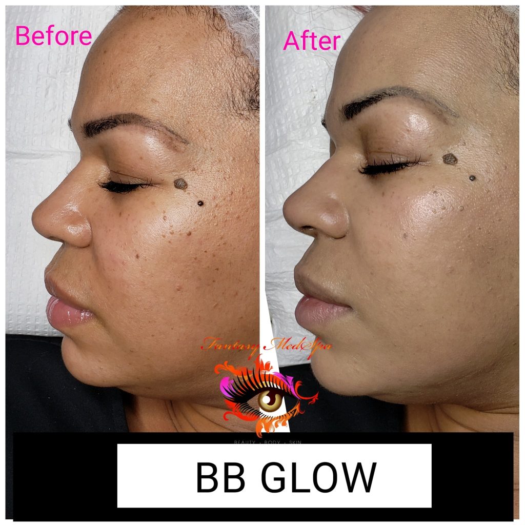 BB Glow (semi-permanent foundation) – Fantasy MedSpa